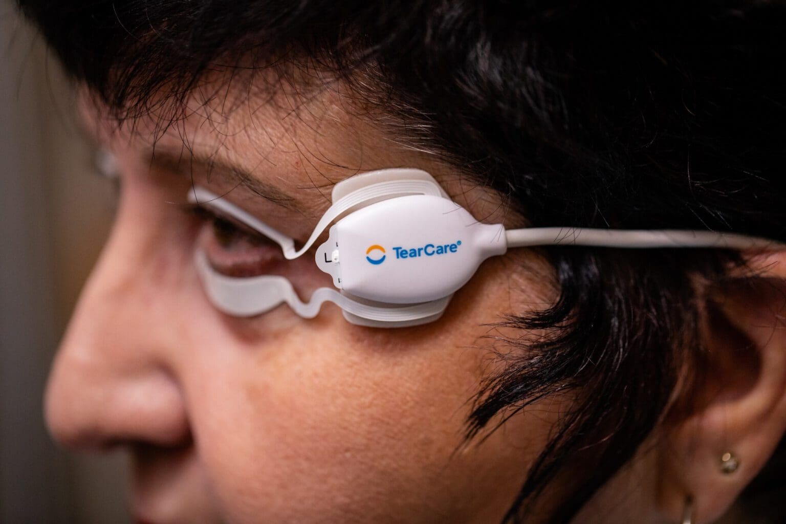 About the TearCare® System: What It Treats & How It Works