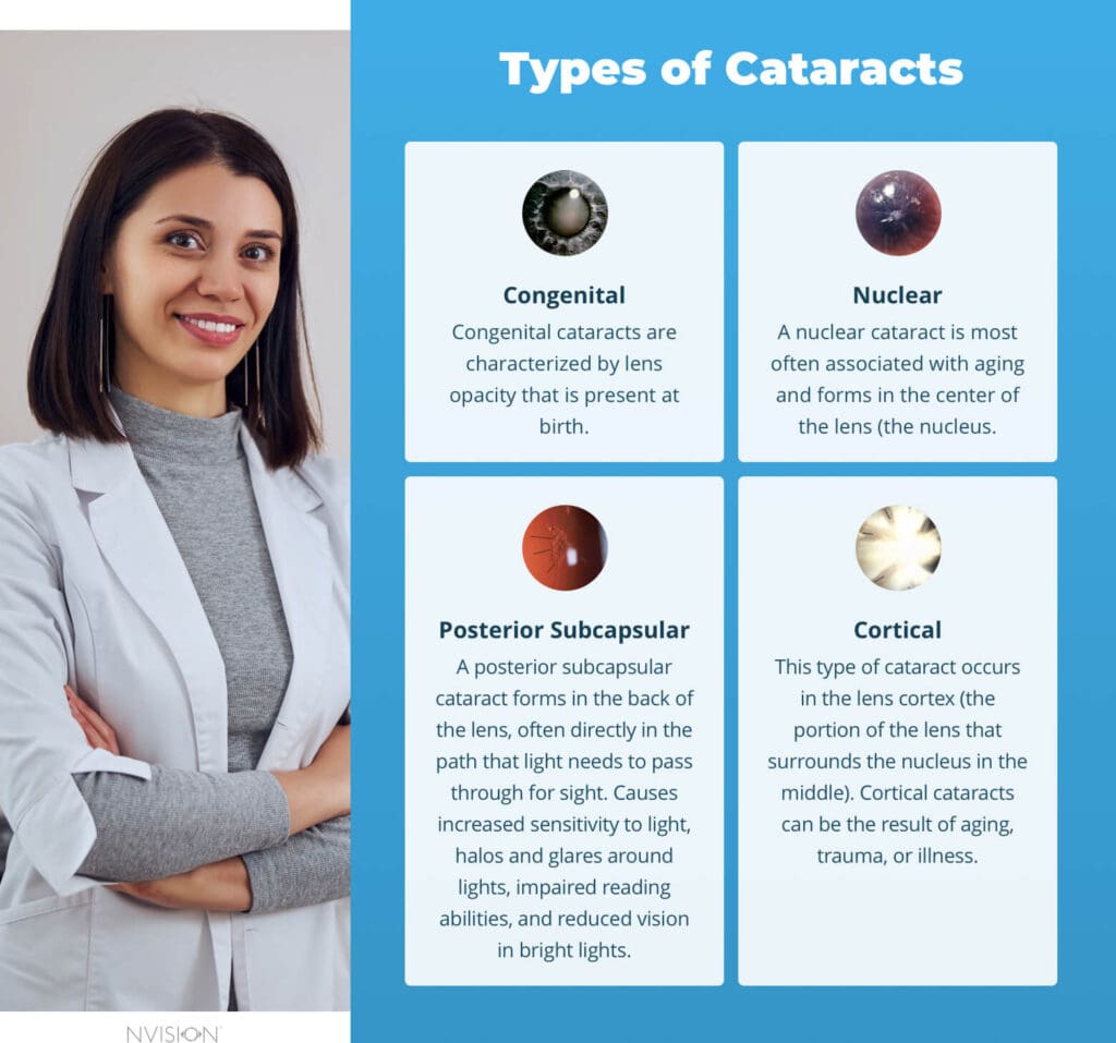 Types of Cataracts | Comparing the Different Cataract Types