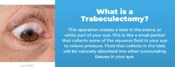 Trabeculectomy Surgery: Risks, Recovery & How It Works | NVISION