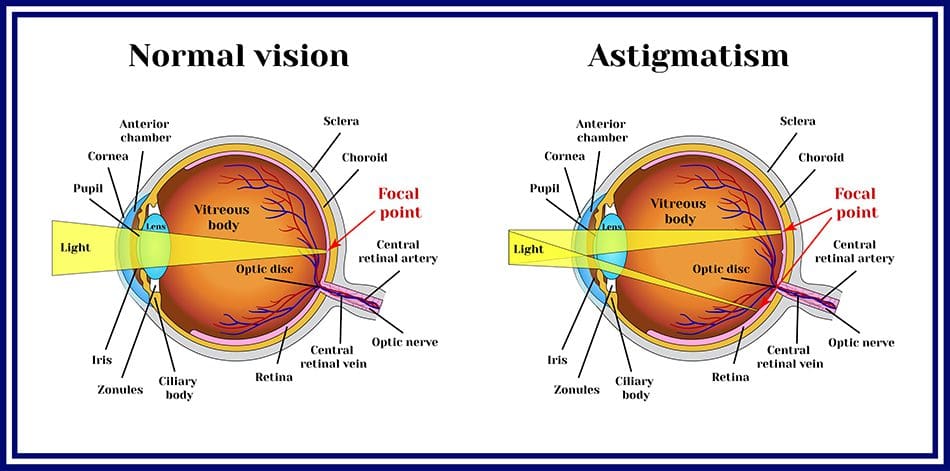 The Best Contact Lenses In 2022 How To Choose NVISION Eye Centers The Best Contact Lenses In 2022 How To Choose NVISION Eye Centers