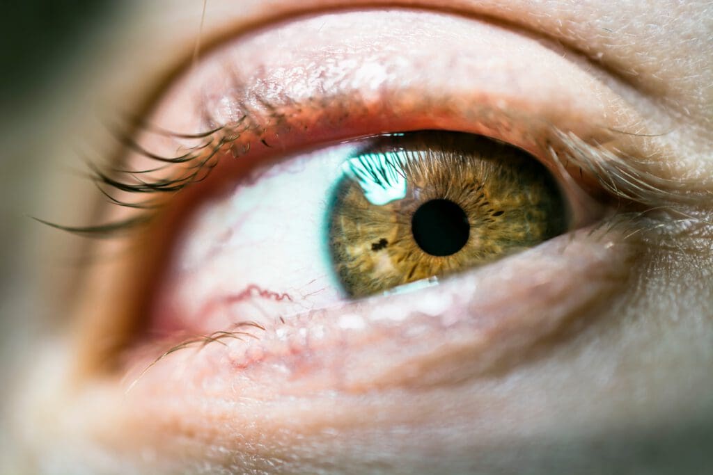 Why Do I Have Pinpoint Pupils 6 Causes Nvision