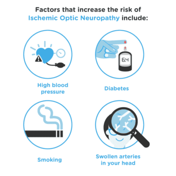 Neurological Disorders and Eyesight – NVISION
