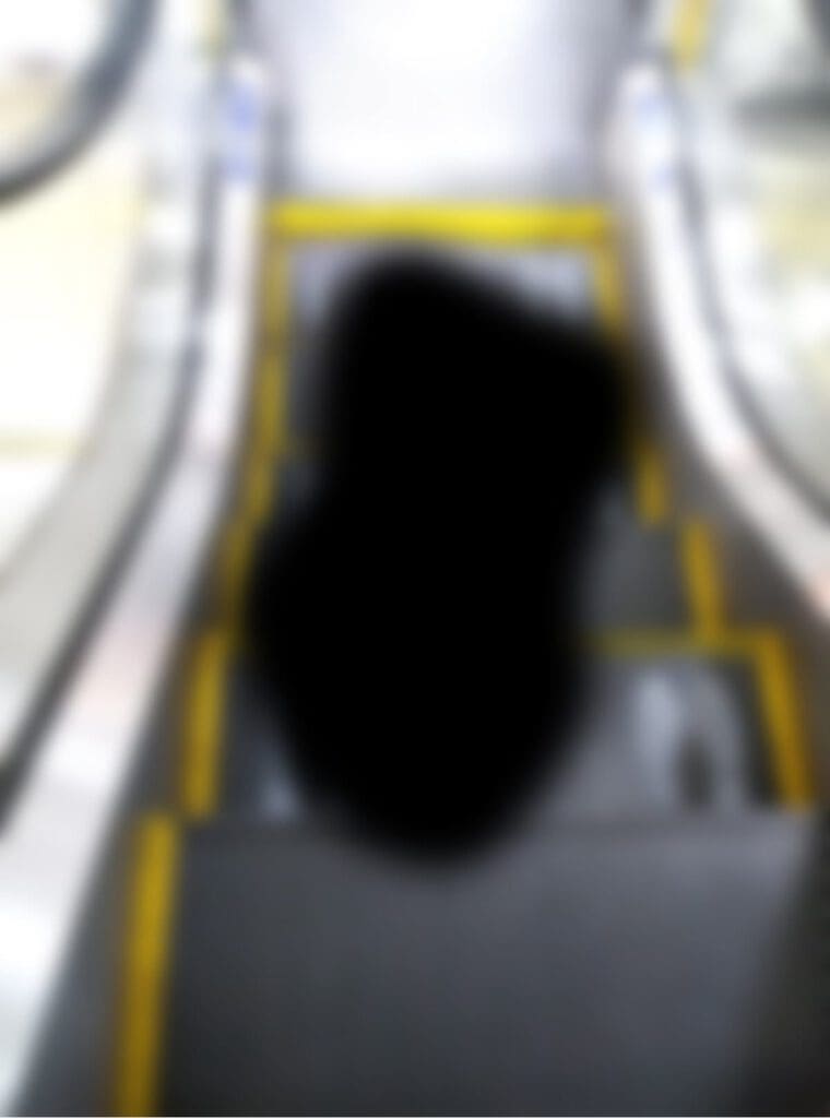 Scotoma (Blind Spot in Eye): Causes, Symptoms & Treatment