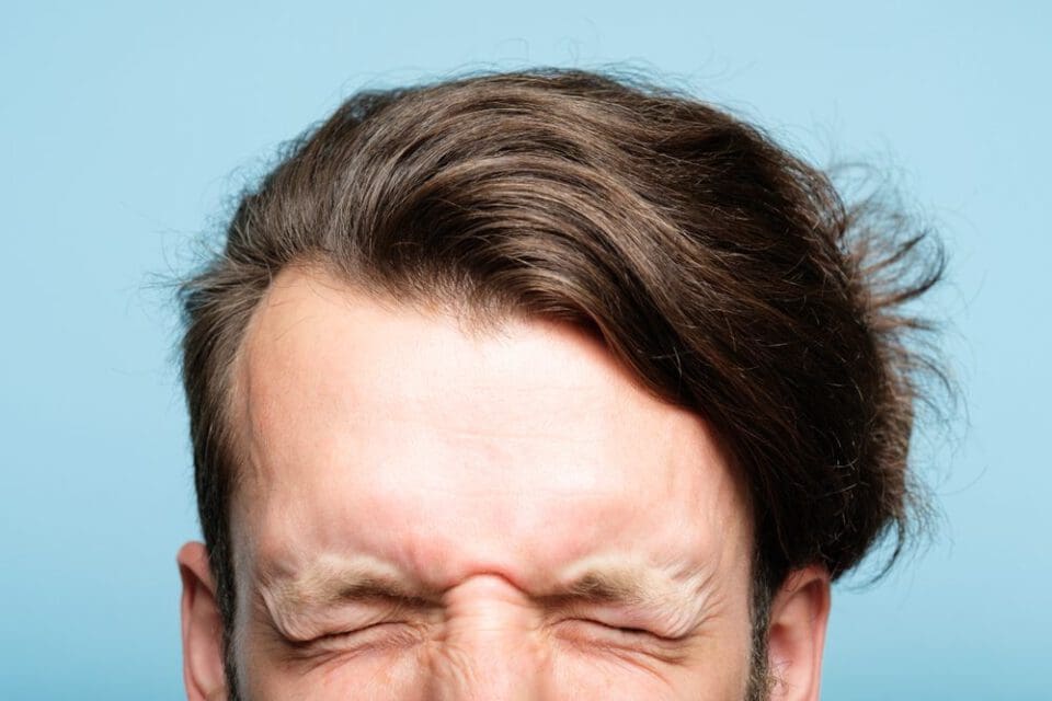 Eye Damage From Solar Eclipses: Why it Happens (& Prevention) – NVISION