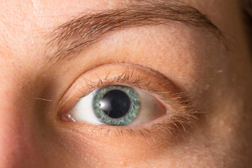 What Drugs Cause Dilated Pupils? – NVISION