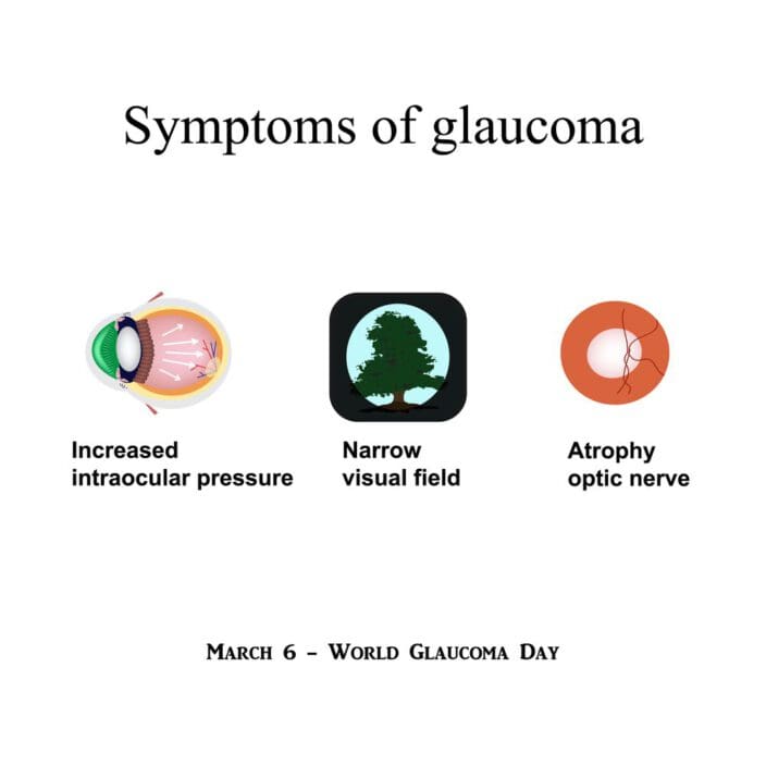 The Causes of High Eye Pressure (& How to Treat Them) – NVISION